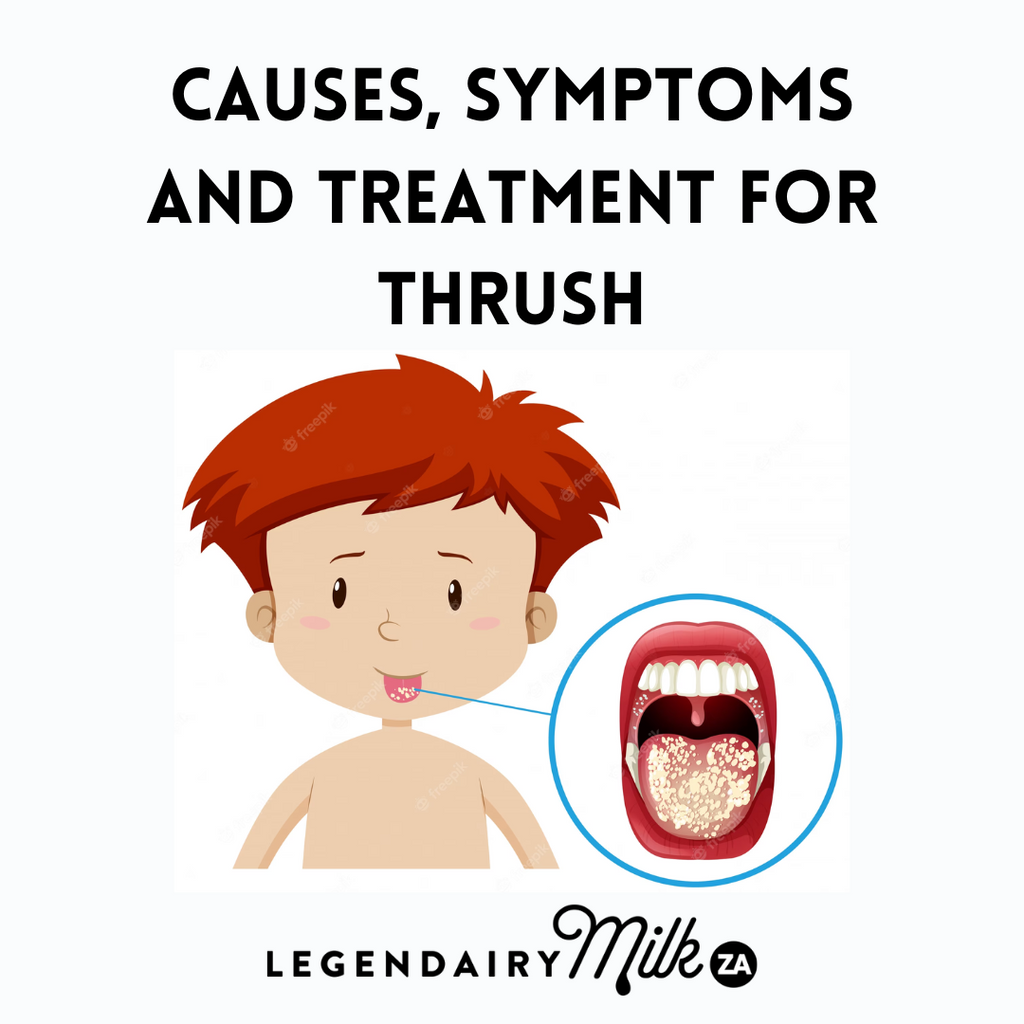 Thrush: Causes, Symptoms, and Treatment – Legendairy Milk South Africa